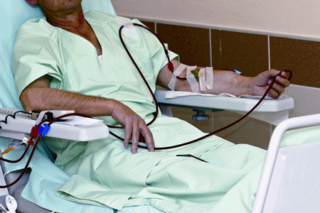 CAPD, its current status and future in India - India News | The ...