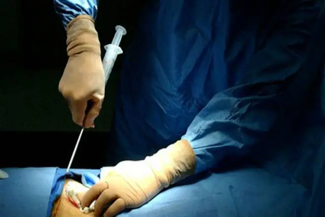 How LifeCell became the most accredited stem cell bank in India ...