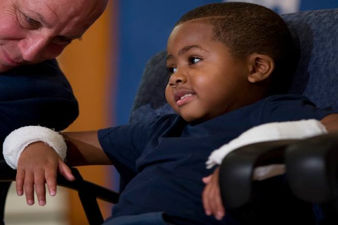World’s first double hand transplant on child a success - Life News ...