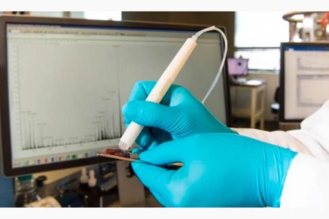 Scientists develop pen-like device that accurately identifies cancer in ...