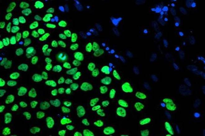 First human oesophagus created in lab using stem cells - Science News ...