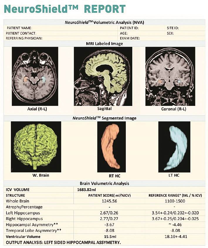 NEUROShield: Cutting-edge diagnostics for early detection of brain ...