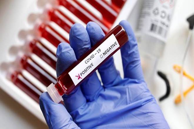 Coronavirus: Noida govt hospital claims over one lakh RT-PCR tests ...