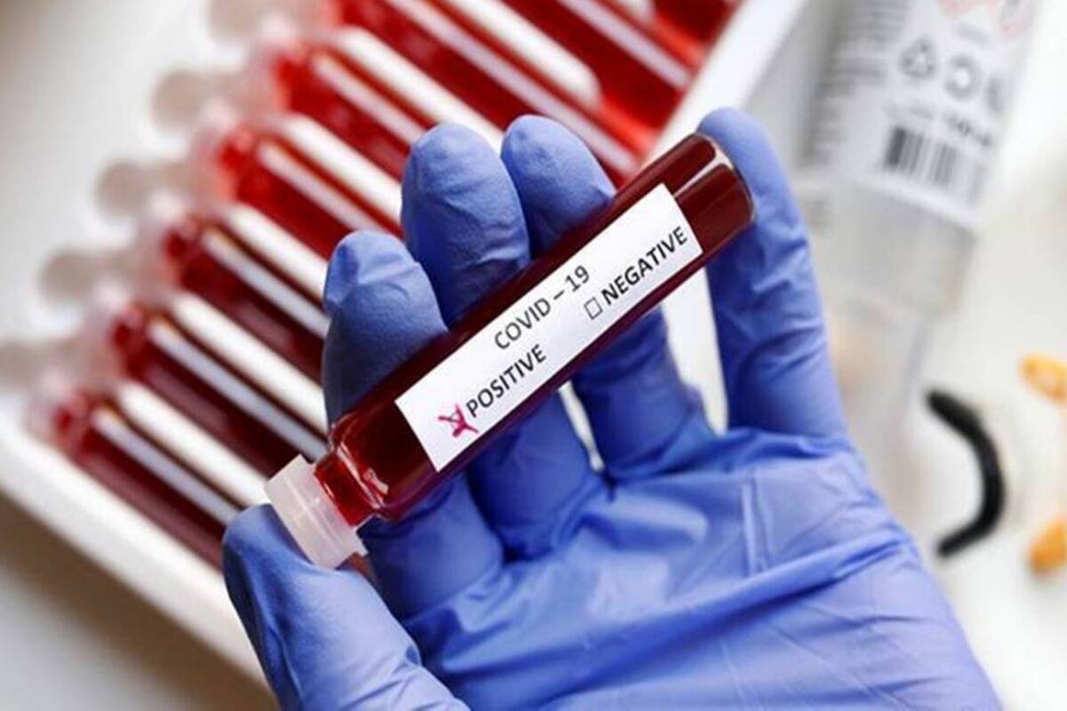 Maharashtra gives RT-PCR test report exemption to travellers having 15 ...