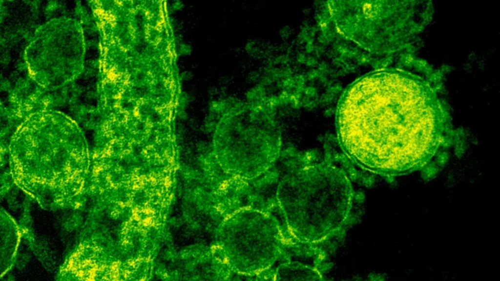 'Death within 48 hours' - Japan reports sharp spike in flesh-eating ...